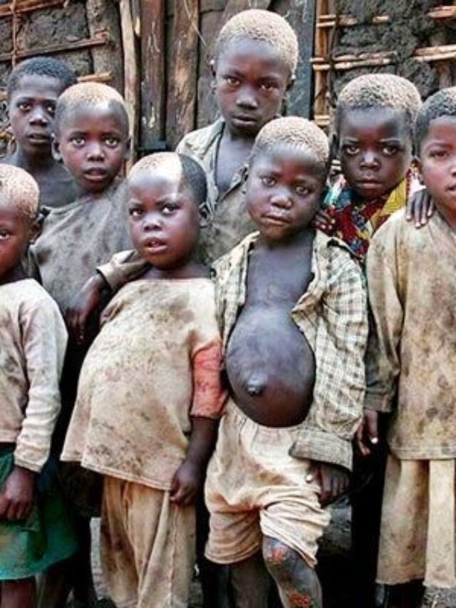 Prevention of Poverty in Africa - See Africa Today