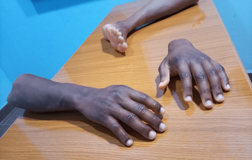 Meet John Amanam, the Nigerian Sculptor Designing Prosthetics for Amputees