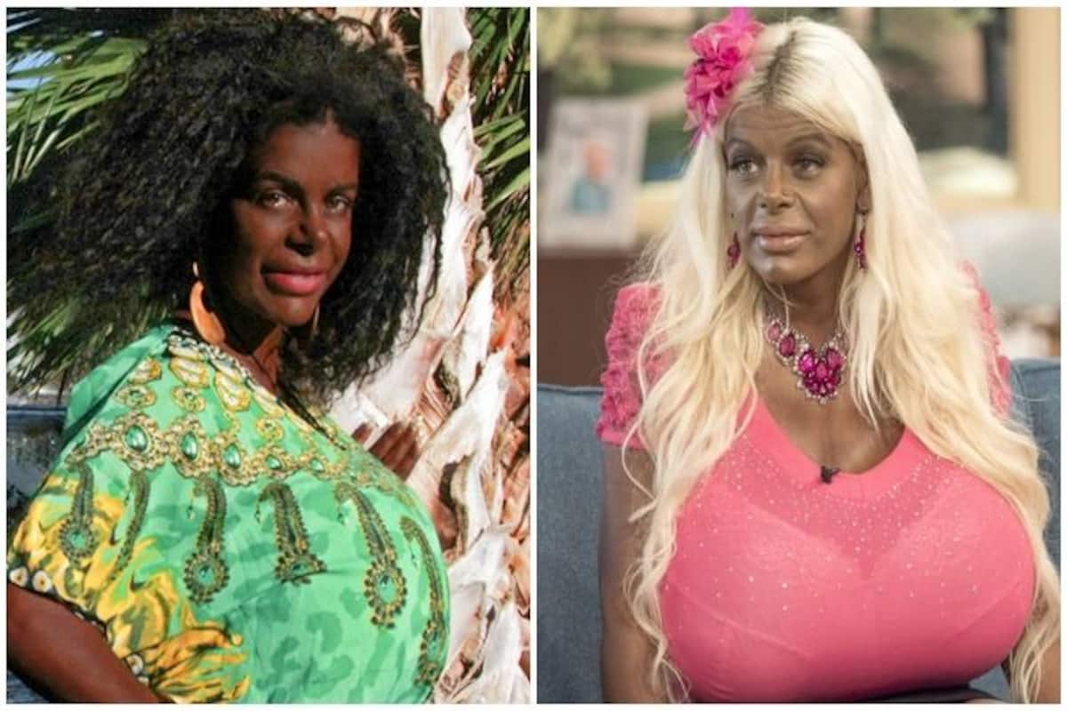 German Model Martina Big Injects Hormone to ‘Become African’ - See ...